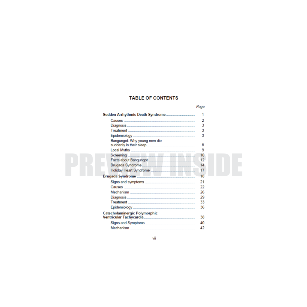 Bangungot (Brugada) Syndrome – Centralbooks